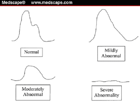 Peripheral Vascular Pearls